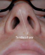 Septum | Encyclopedia.com