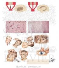 Brain Death | Encyclopedia.com