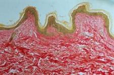 Epidermis | Encyclopedia.com