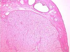 Corpus Luteum | Encyclopedia.com