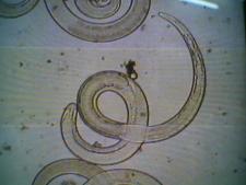 Trichina | Encyclopedia.com