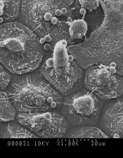 Pseudopodia | Encyclopedia.com