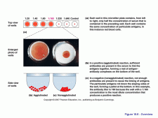 Agglutination | Encyclopedia.com